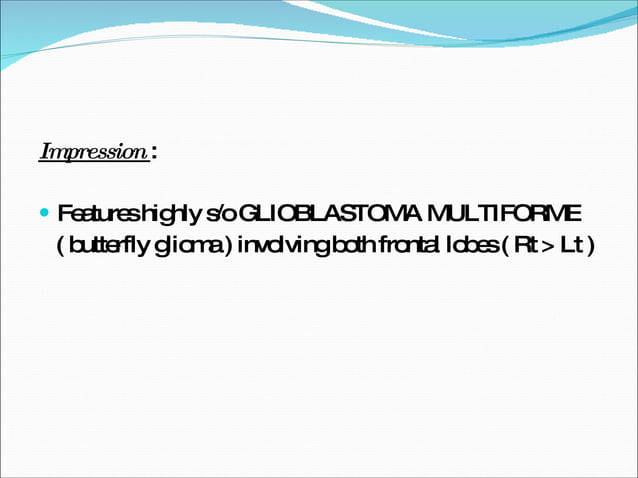 CT Scan: Glioblastoma Multiforme | PPT