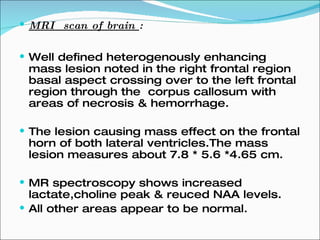 CT:Glioblastoma Multiforme | PPT