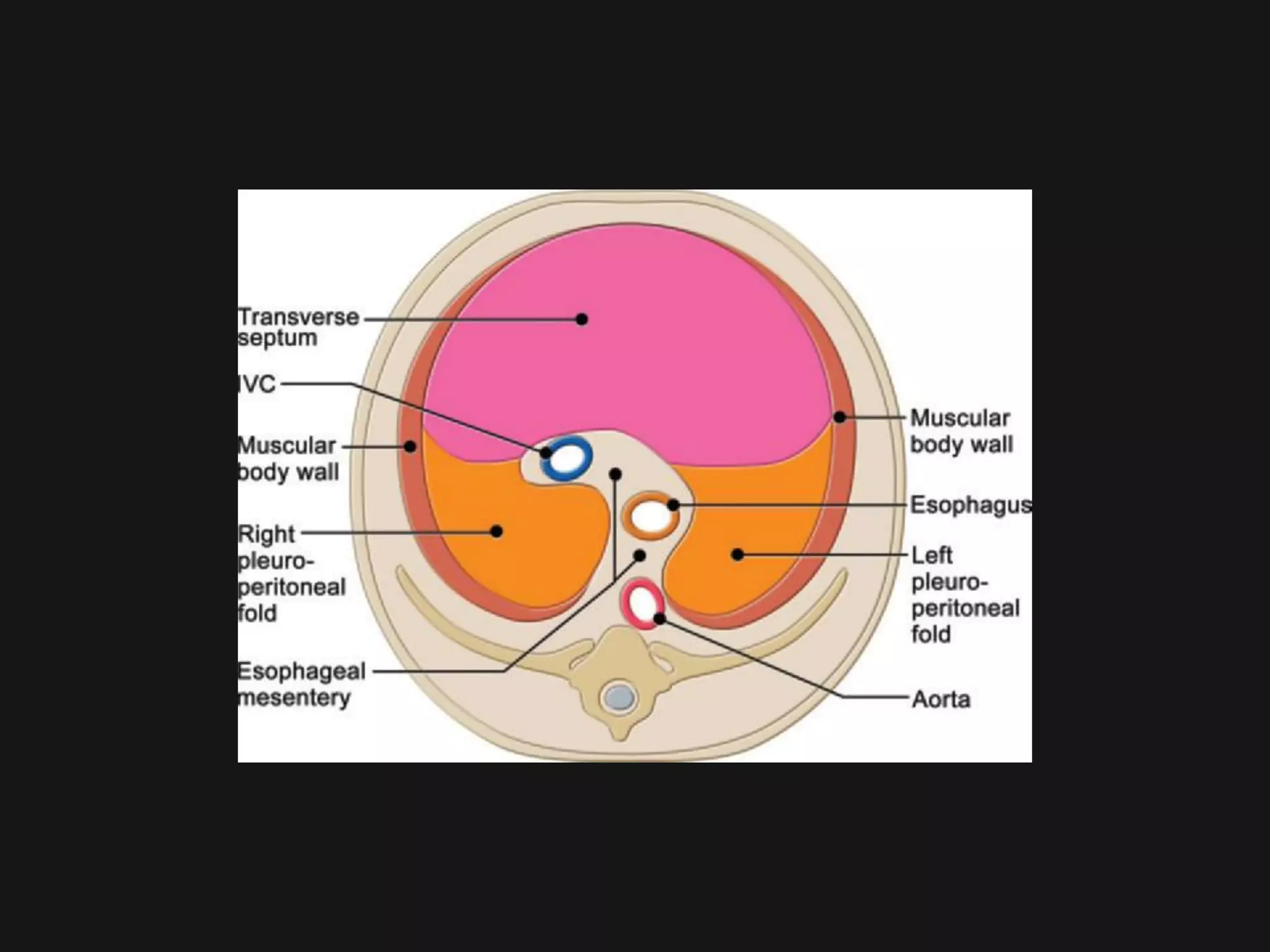 Imaging abdomen trauma diaphragmatic trauma part 7 Dr Ahmed Esawy | PDF