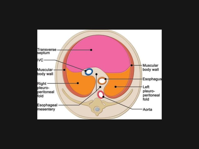 Imaging abdomen trauma diaphragmatic trauma part 7 Dr Ahmed Esawy | PPT