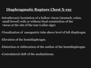 Imaging abdomen trauma diaphragmatic trauma part 7 Dr Ahmed Esawy | PDF