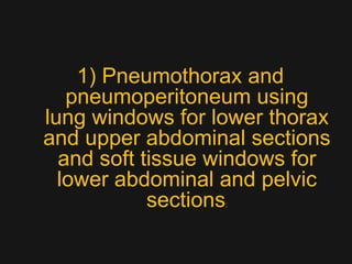 Imaging abdomen trauma introduction part 1 Dr Ahmed Esawy | PDF