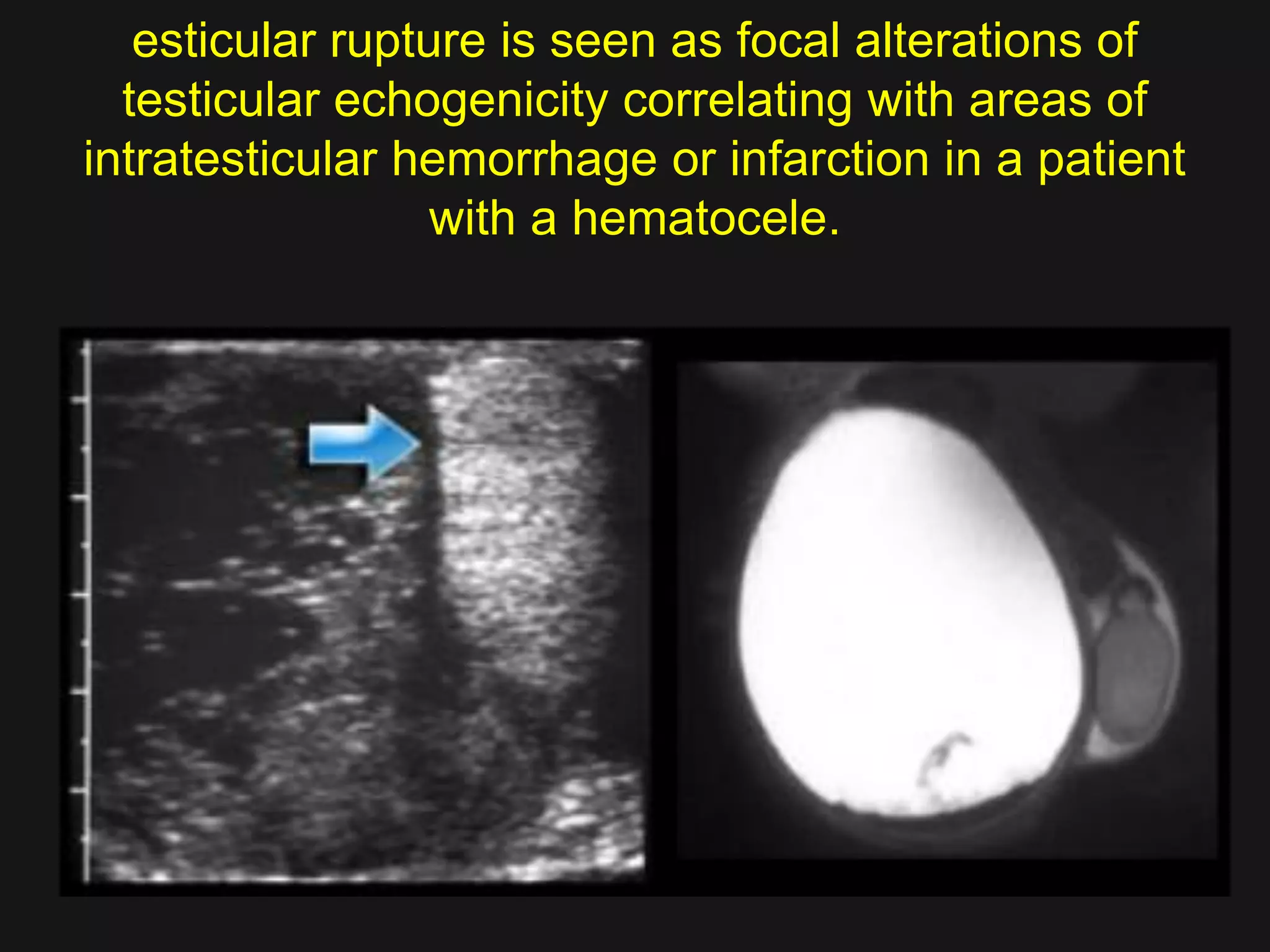 Imaging abdomen trauma male geniital part 10 Dr Ahmed Esawy | PDF