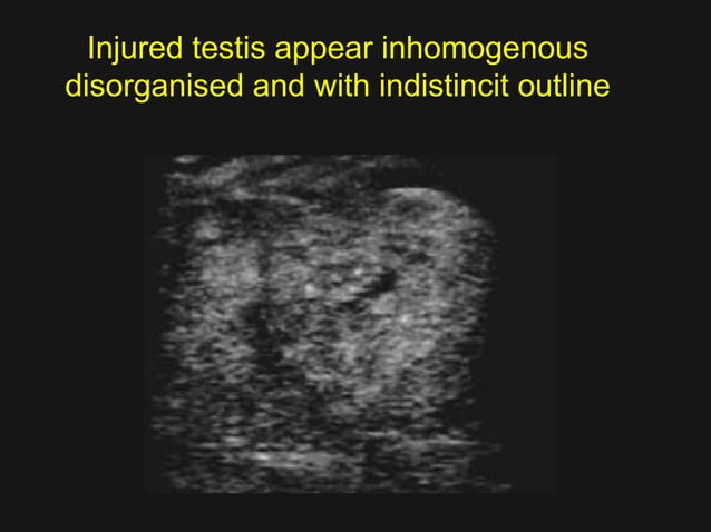 Imaging abdomen trauma male geniital part 10 Dr Ahmed Esawy | PDF