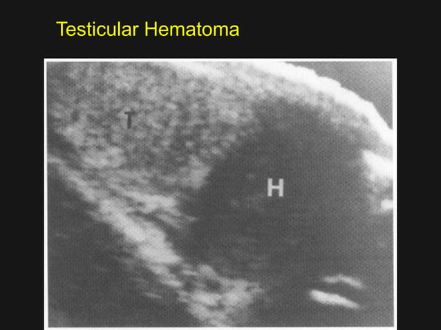 Imaging abdomen trauma male geniital part 10 Dr Ahmed Esawy | PDF