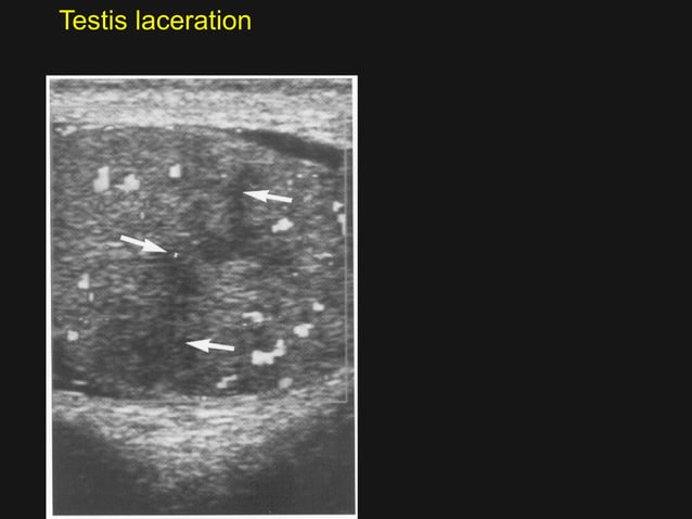 Imaging abdomen trauma male geniital part 10 Dr Ahmed Esawy | PDF