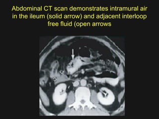 Imaging abdomen trauma mesenteric bowel trauma part 6 Dr Ahmed Esawy | PDF