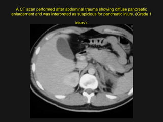 Imaging abdomen trauma pancreatic trauma part 4 Dr Ahmed Esawy | PDF