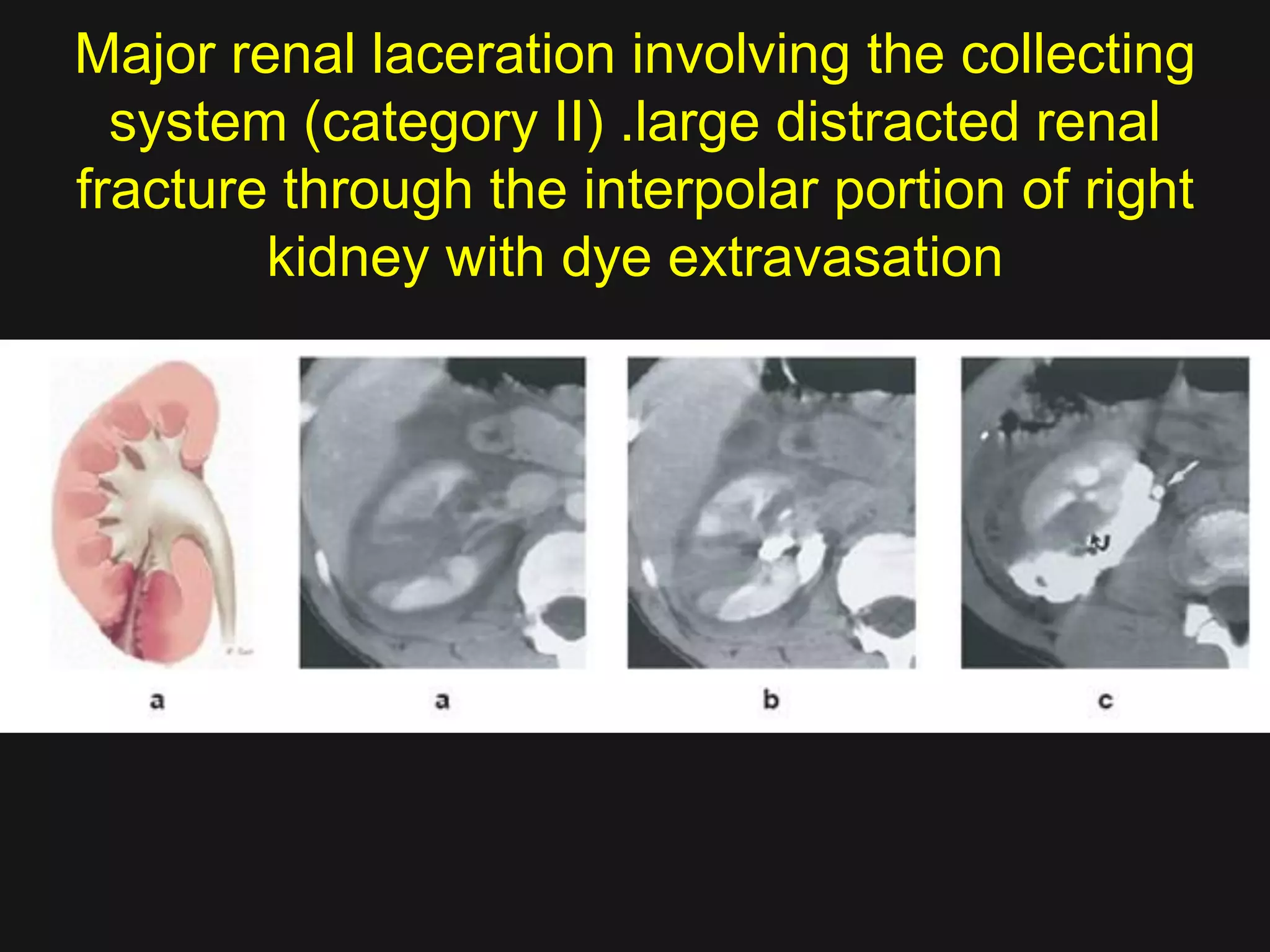 Imaging abdomen trauma renal part 5 Dr Ahmed Esawy | PPT