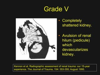 Imaging abdomen trauma renal part 5 Dr Ahmed Esawy | PDF
