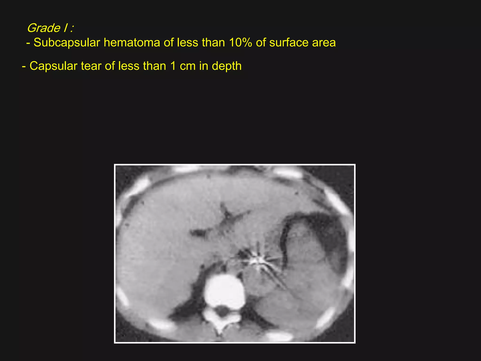 Imaging abdomen trauma spleenic trauma part 3 Dr Ahmed Esawy | PDF