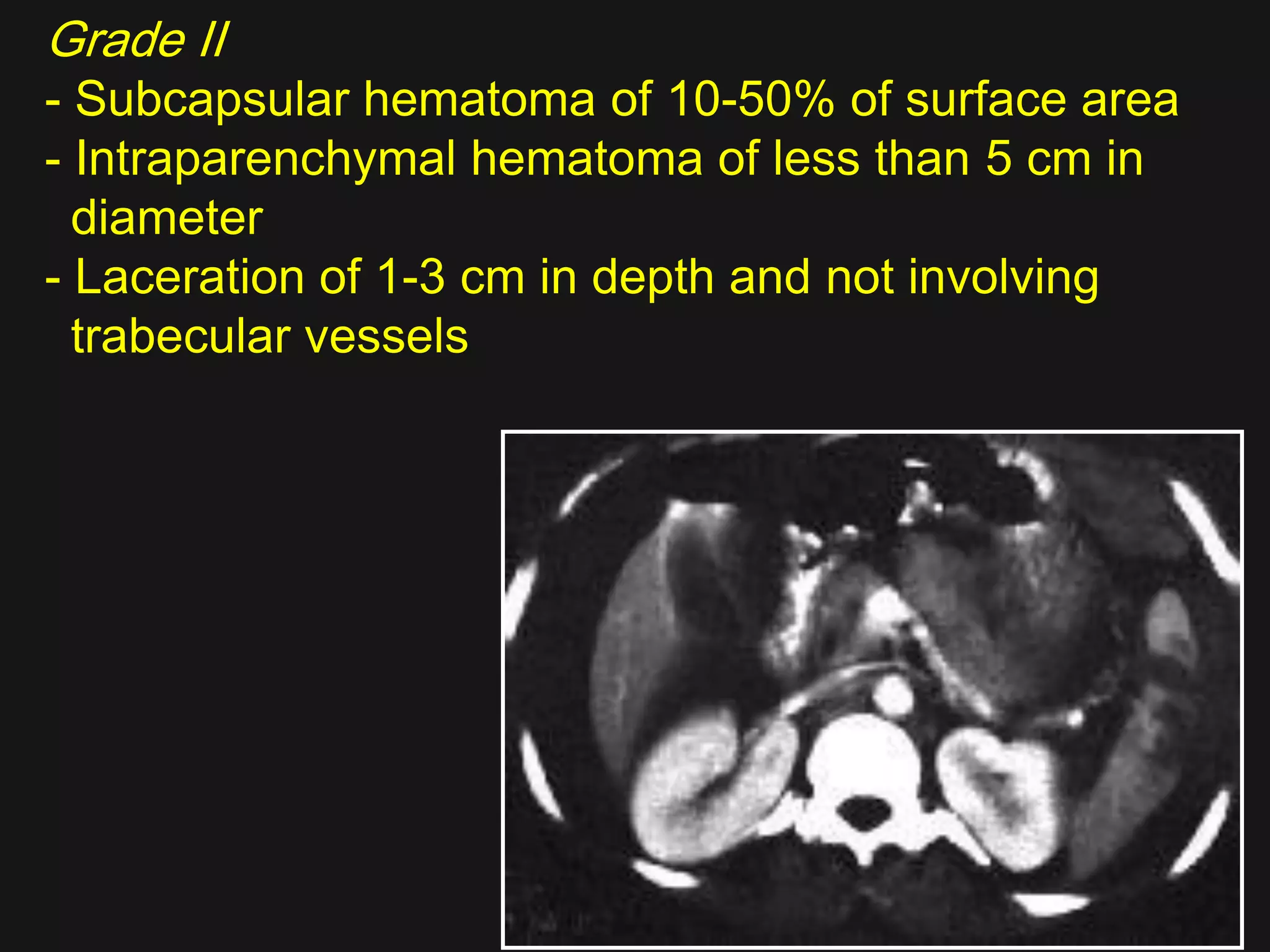 Imaging abdomen trauma spleenic trauma part 3 Dr Ahmed Esawy | PDF