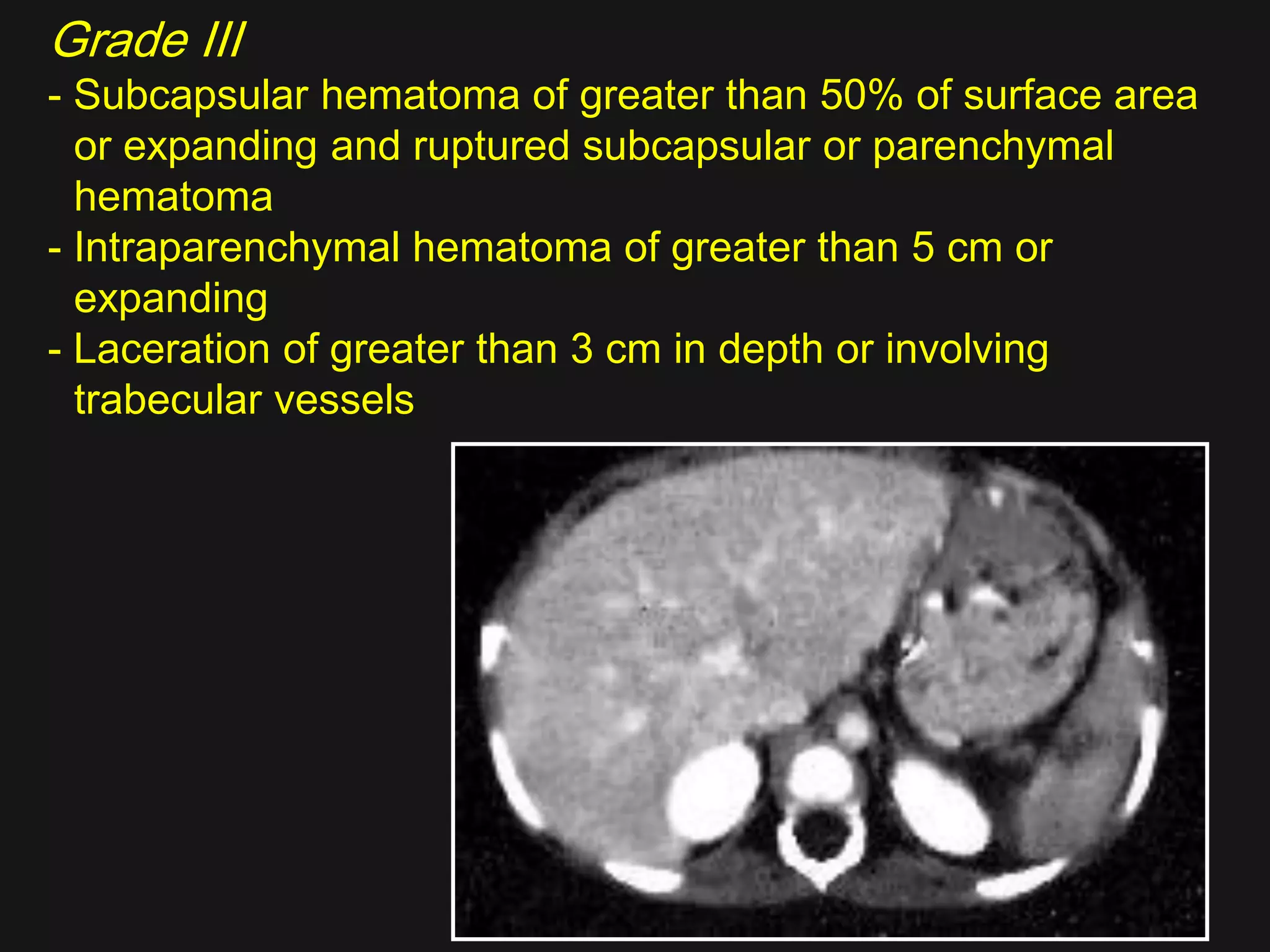 Imaging abdomen trauma spleenic trauma part 3 Dr Ahmed Esawy | PDF