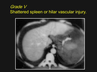 Imaging abdomen trauma spleenic trauma part 3 Dr Ahmed Esawy | PDF
