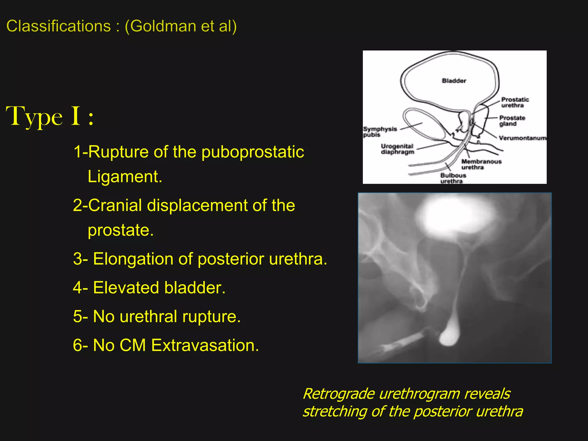 Imaging abdomen trauma urethra trauma part 9 Dr Ahmed Esawy | PPT