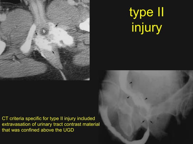 Imaging abdomen trauma urethra trauma part 9 Dr Ahmed Esawy | PPT