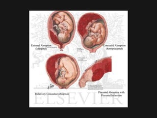Imaging abdomen trauma uterine trauma part 11 Dr Ahmed Esawy | PDF