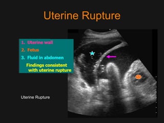 Imaging abdomen trauma uterine trauma part 11 Dr Ahmed Esawy | PDF