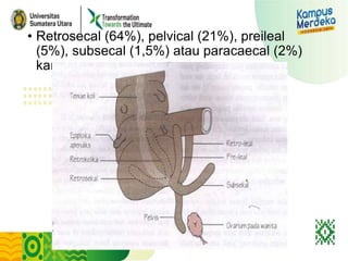 imaging acute appendicitisss.ppt