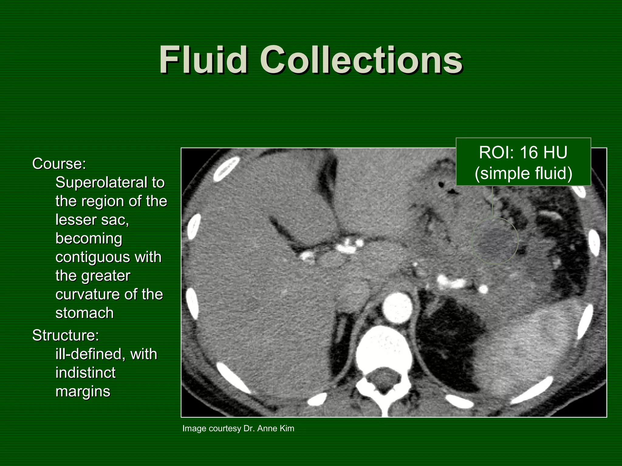 Imaging acute pancreatitis | PPT