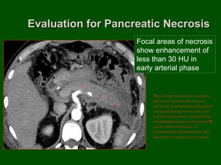 Imaging acute pancreatitis | PPT