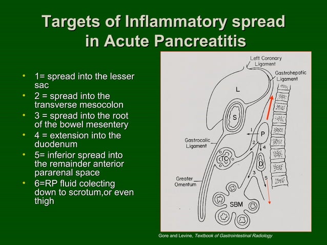 Imaging acute pancreatitis | PPT