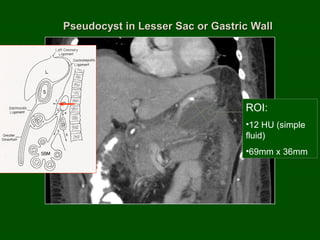 Lesser Sac Ultrasound