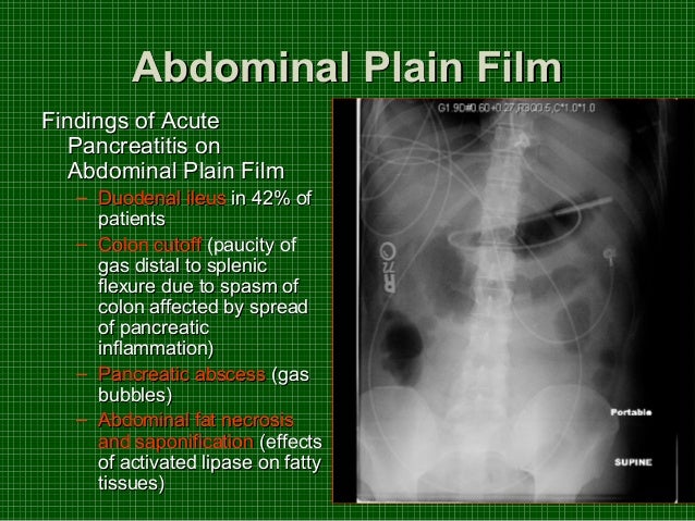 Imaging acute pancreatitis