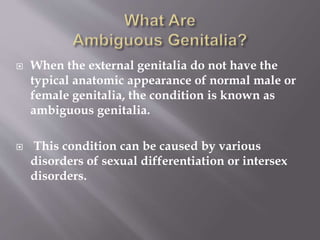 Imaging ambigous genitalia | PPTX