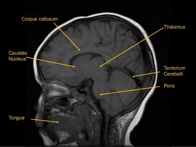 Imaging in neurology - normal anatomy