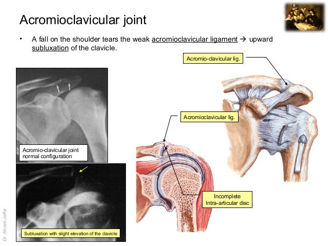 Acromioclavicular Joint Anatomy