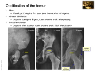 Imaging anatomy dislocation of the hip joint | PPT