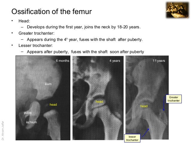 Imaging anatomy dislocation of the hip joint