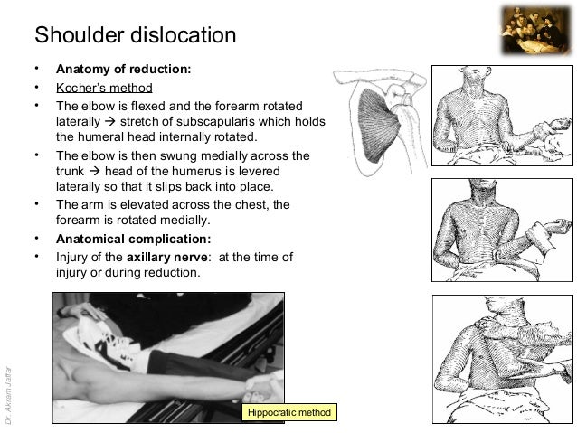 Imaging anatomy dislocation of the shoulder