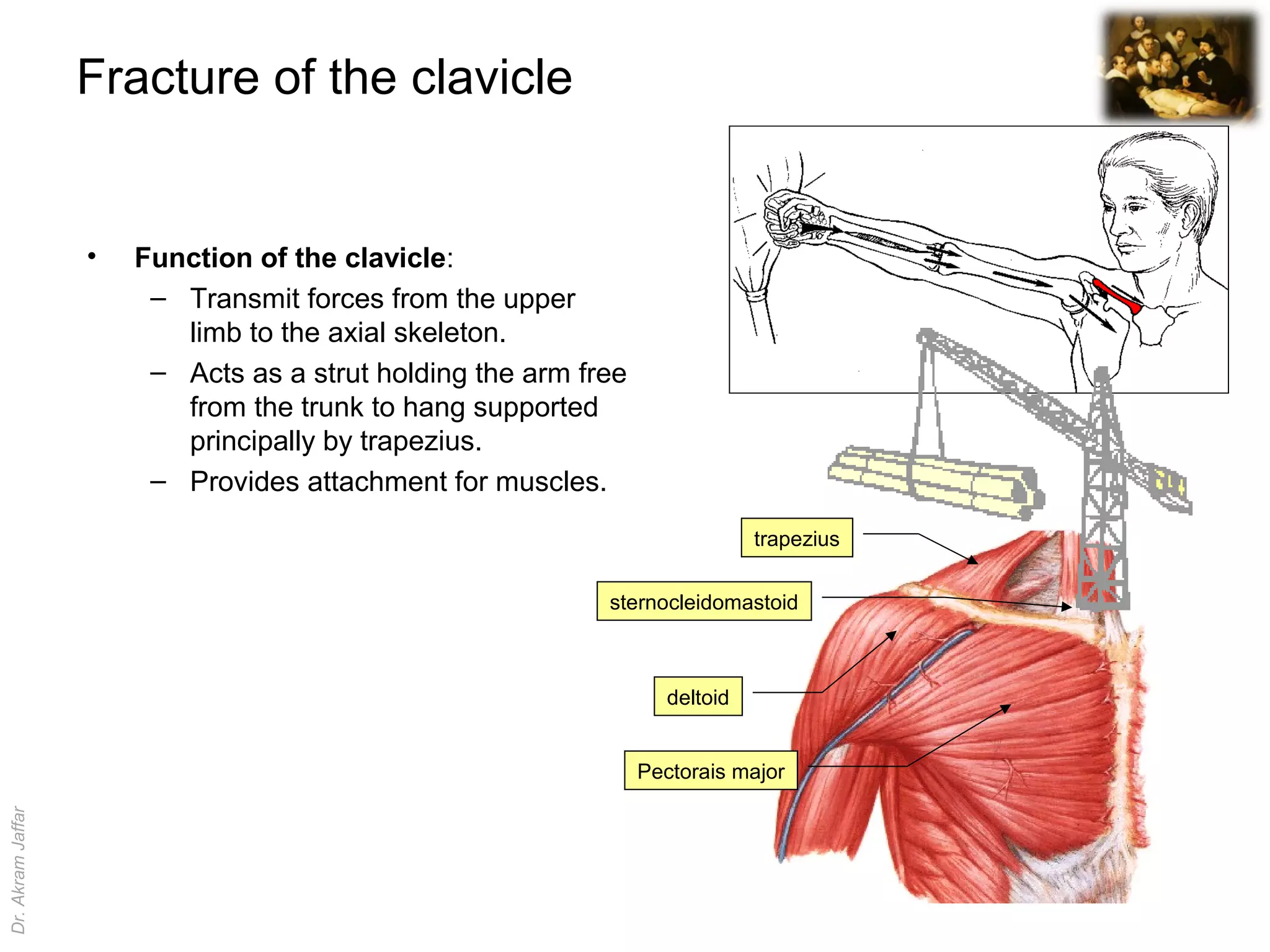 Imaging anatomy fracture of the clavicle | PPT