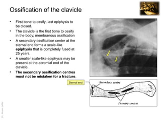 Imaging anatomy fracture of the clavicle | PPT