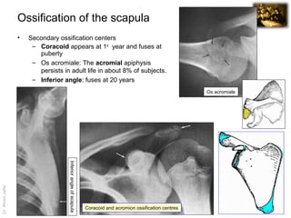 Imaging anatomy fracture of the scapula | PPT