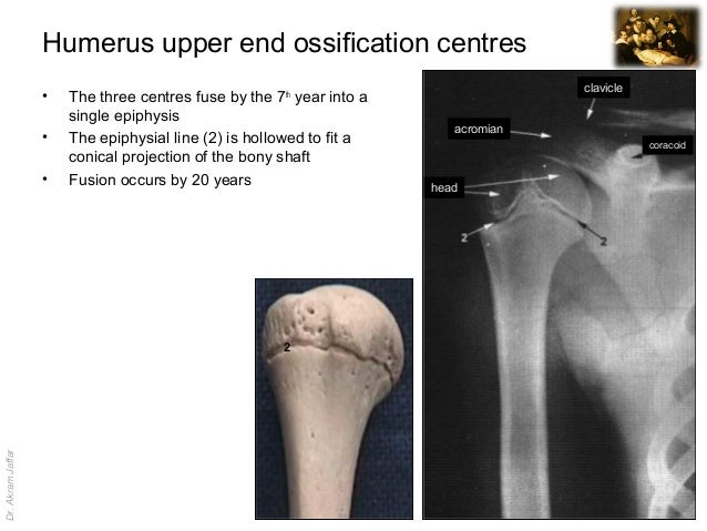 Imaging anatomy fractures of the humerus