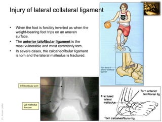 Imaging anatomy injuries of the leg and foot | PPT | Free Download