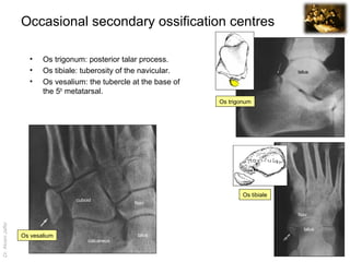 Imaging anatomy injuries of the leg and foot | PPT