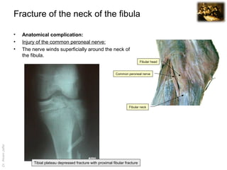 Imaging anatomy injuries of the leg and foot | PPT