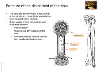 Imaging anatomy injuries of the leg and foot | PPT | Free Download