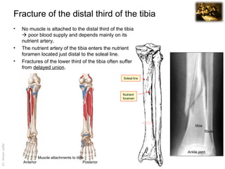 Imaging anatomy injuries of the leg and foot | PPT