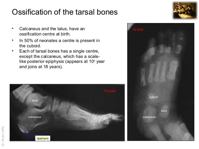 Imaging anatomy injuries of the leg and foot