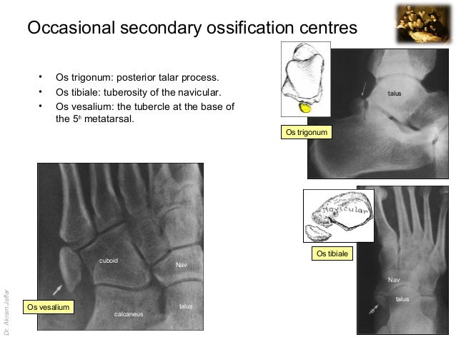 Imaging anatomy injuries of the leg and foot