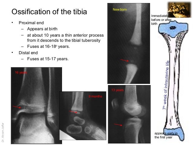 Imaging anatomy injuries of the leg and foot