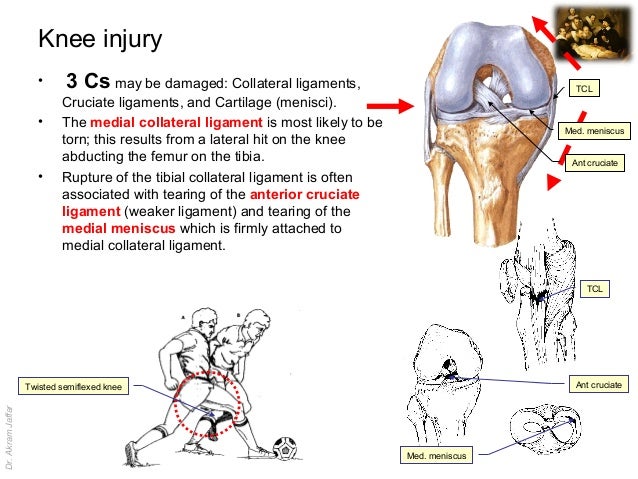 Knee Injuries Anatomical Chart Image Knee Joint Anatomy Chart | Health ...