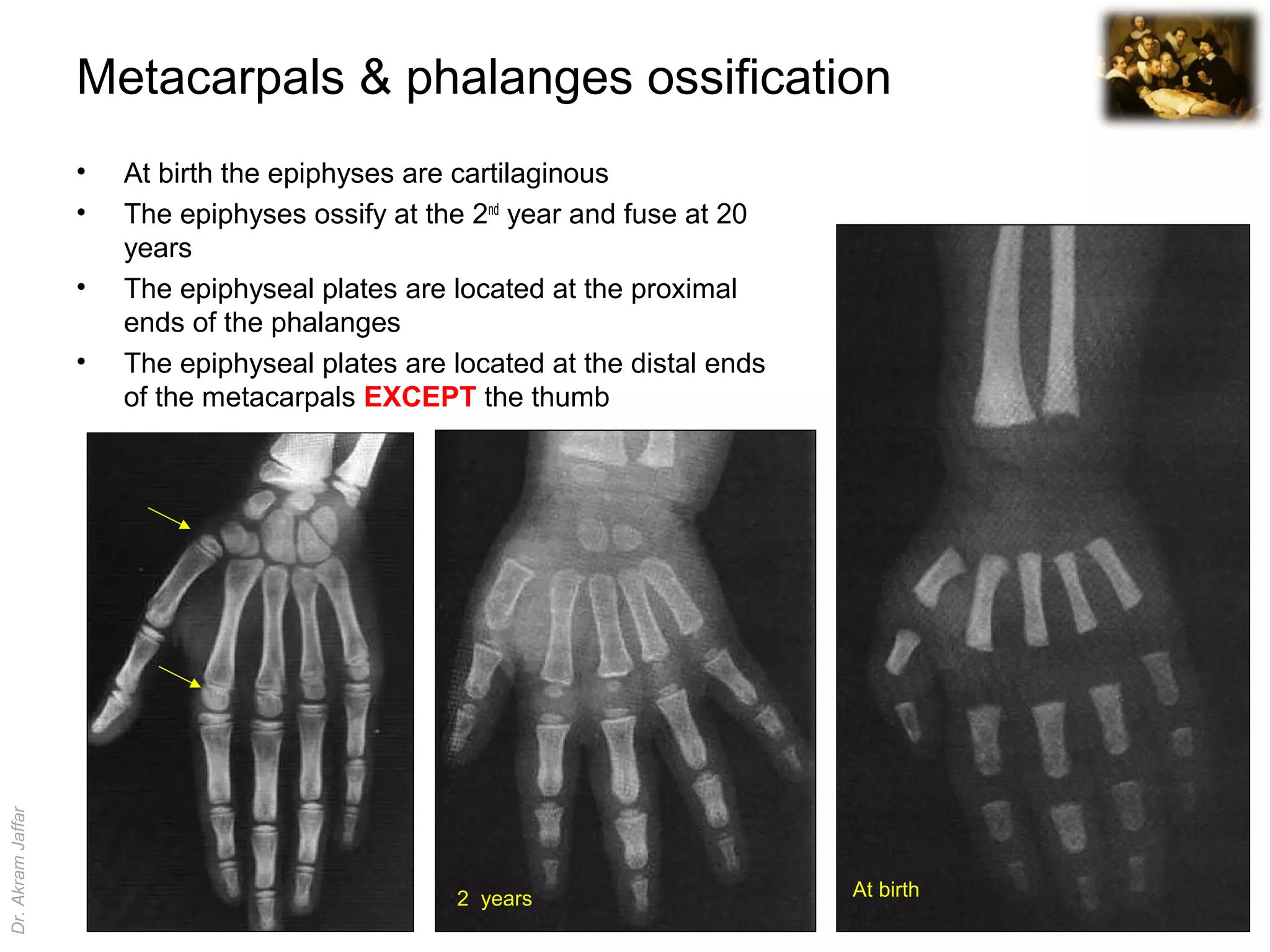 Imaging anatomy mallet finger | PPT