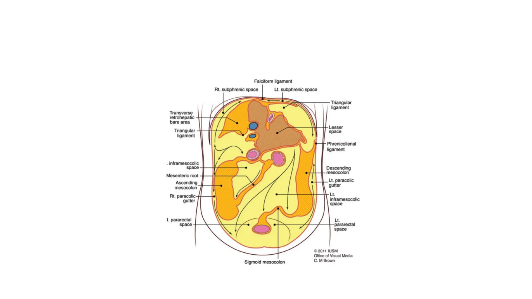 IMAGING ANATOMY OF PERITONEAL SPACES.pptx