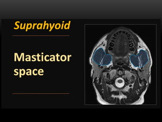 IMAGING ANATOMY OF SUPRAHYOID NECK SPACES copy.pptx